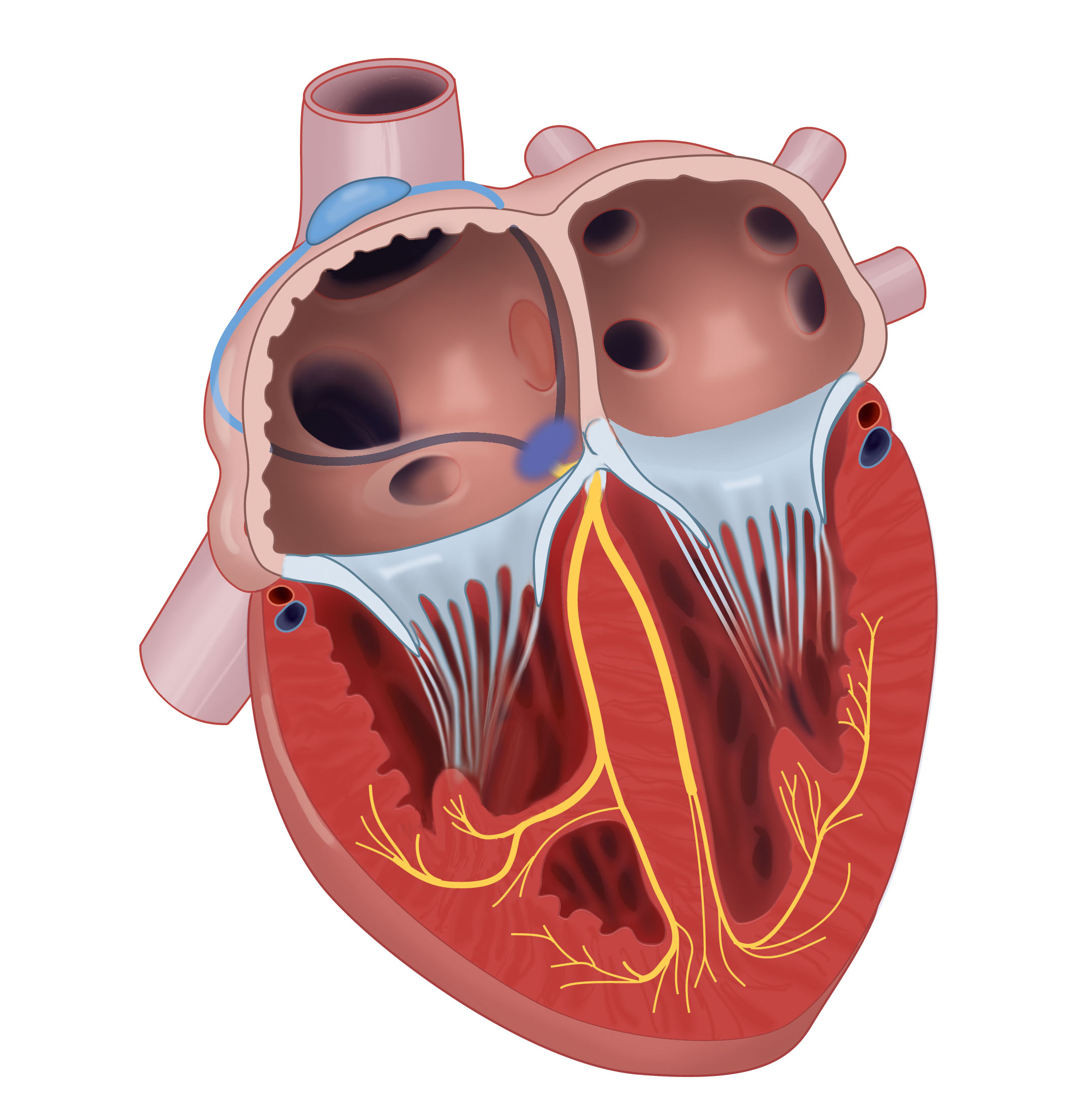 Leiden - Drawing The cardiac conduction system - no labels | AnatomyTOOL Leiden - Drawing The cardiac conduction system - no labels | AnatomyTOOL